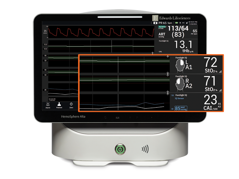 ForeSight IQ™ Sensor | BD