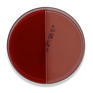 BD BBL™ Columbia CNA Agar with 5% Sheep Blood and MacConkey II Agar Bi ...
