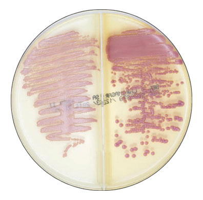 BD BBL™ CHROMagar™ MRSAII /CHROMagar™ SA Bi-plate 100pk - 215421 | BD