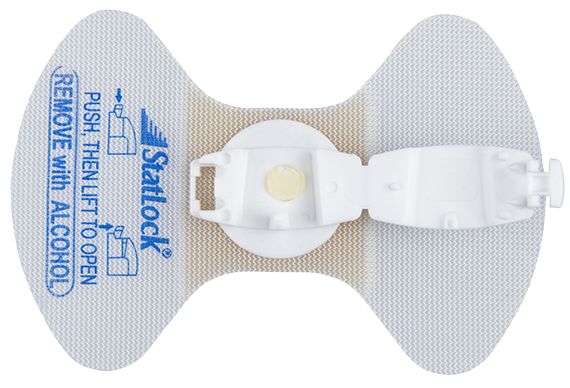 BD® StatLock™ Dialysis Butterfly, Clamp, Butterfly Tricot - DI0120CE | BD