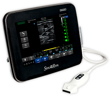 Site-Rite™ Halcyon™ Ultrasound System - 950041600 | BD