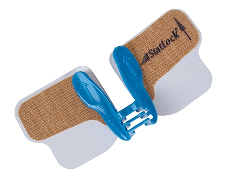 StatLock™ IV Ultra Neonate Blue, Cotton, Sterile - IV0501 | BD