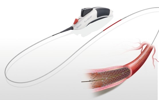 LIFESTENT™ SOLO™ Vascular Stent System, 100 cm, 6 mm × 200 mm ...