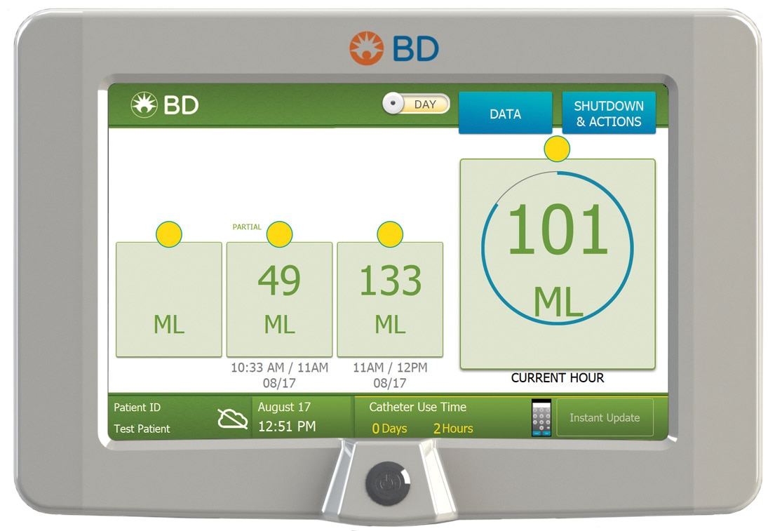 Sensica™ Urine Output System - SCCS1002 | BD