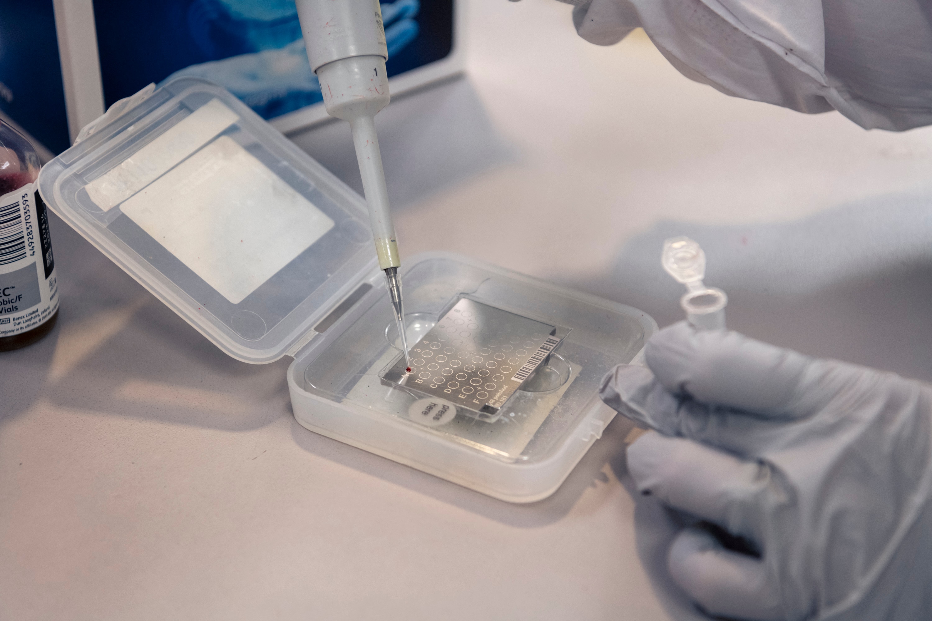 BD™ Bruker MALDI Biotyper® CA System | BD