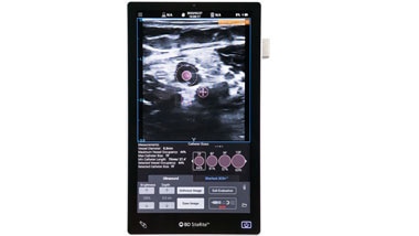 SiteRite™ 9 Ultrasound System