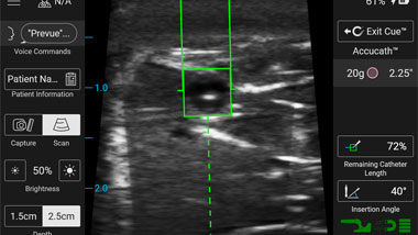SiteRite™ 9 Ultrasound System