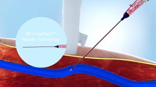 AccuCath™ Ace Intravascular Catheter 2.25” Animation | BD