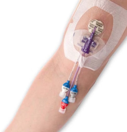 GuardIVa™ antimicrobial hemostatic IV dressing | BD