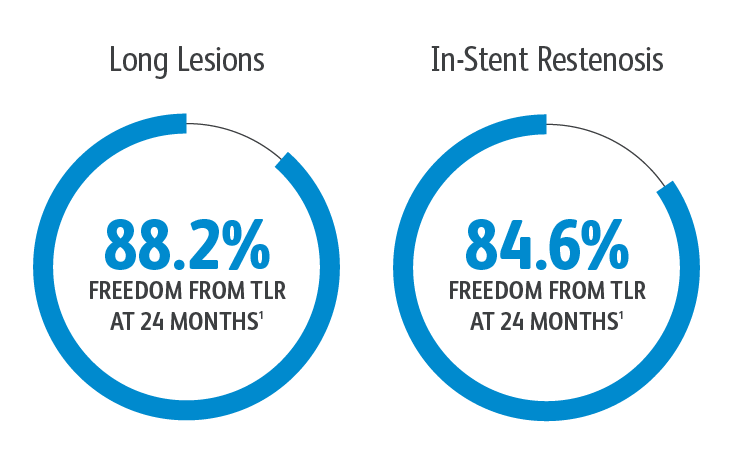 Lutonix™ Drug Coated Balloon PTA Catheters | BD