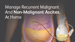 PeritX™ Peritoneal Catheter System | BD United Kingdom