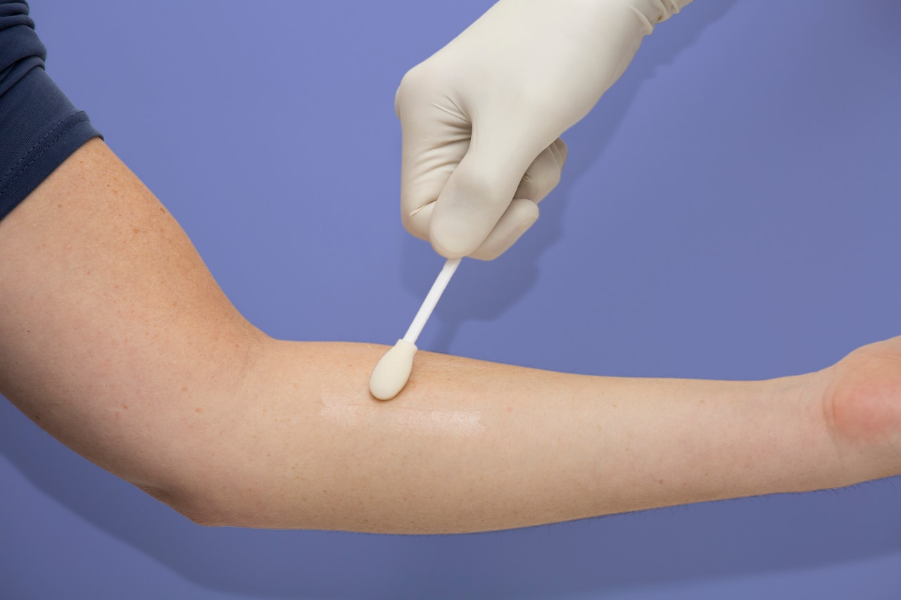 BD ChloraPrepᵀᴹ Swabsticks with Sterile Solution