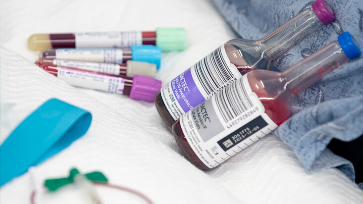 BD Vacutainer® UltraTouch™ push button blood collection set | BD