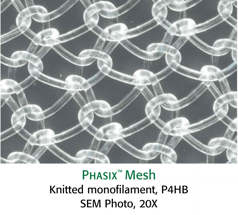 Phasix™ Mesh for Ventral Hernia Repair