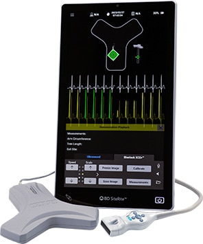 Sherlock 3CG+™ Tip Confirmation System