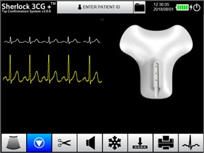 Sherlock 3CG+™ Tip Confirmation System