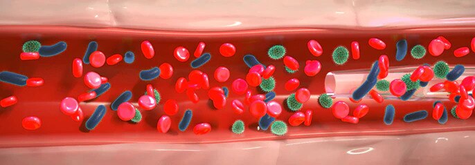 Vascular access management