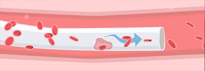Vascular access management