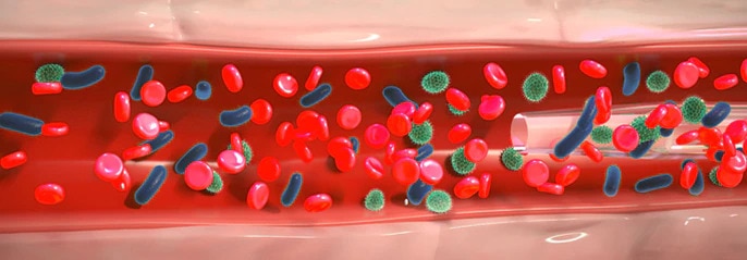 Gestión del acceso vascular