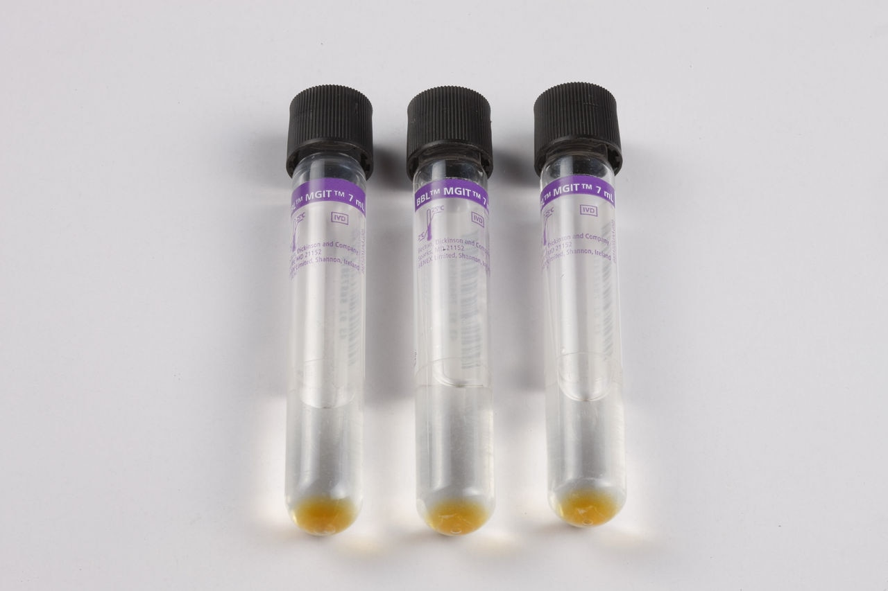 BD ミジット™ 分離培養剤 | BD