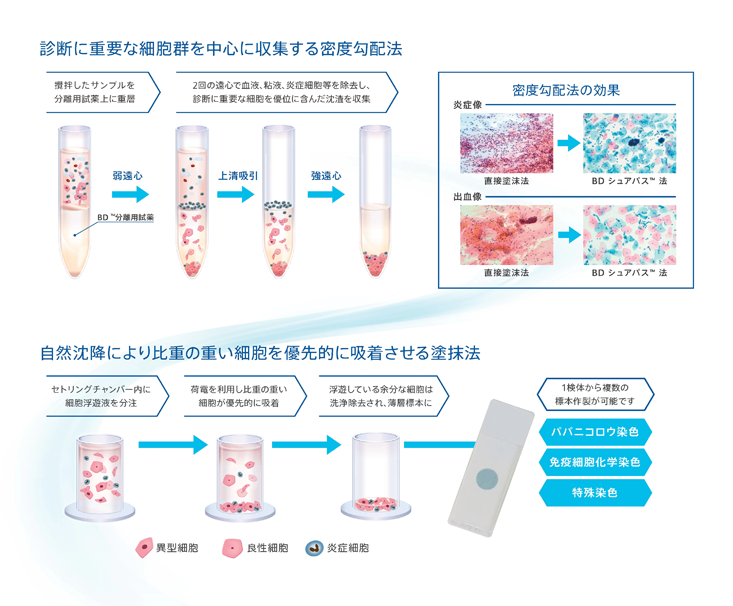 BD シュアパス™ 液状化検体細胞診 | BD